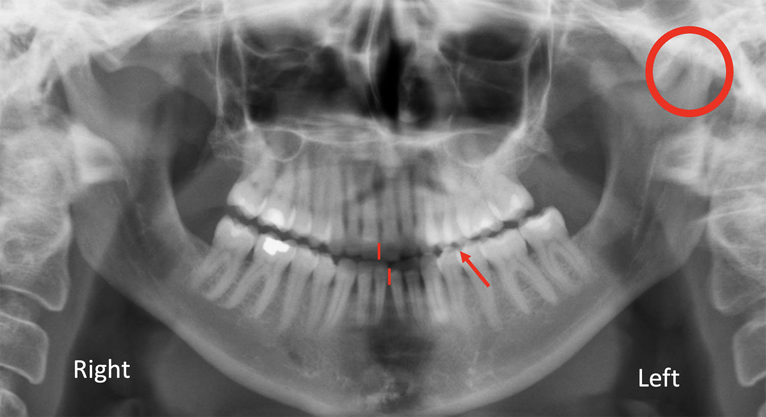 Our Expertise - Jaw Surgeries - TMJ Specialist | Oral Surgeon Arlington ...