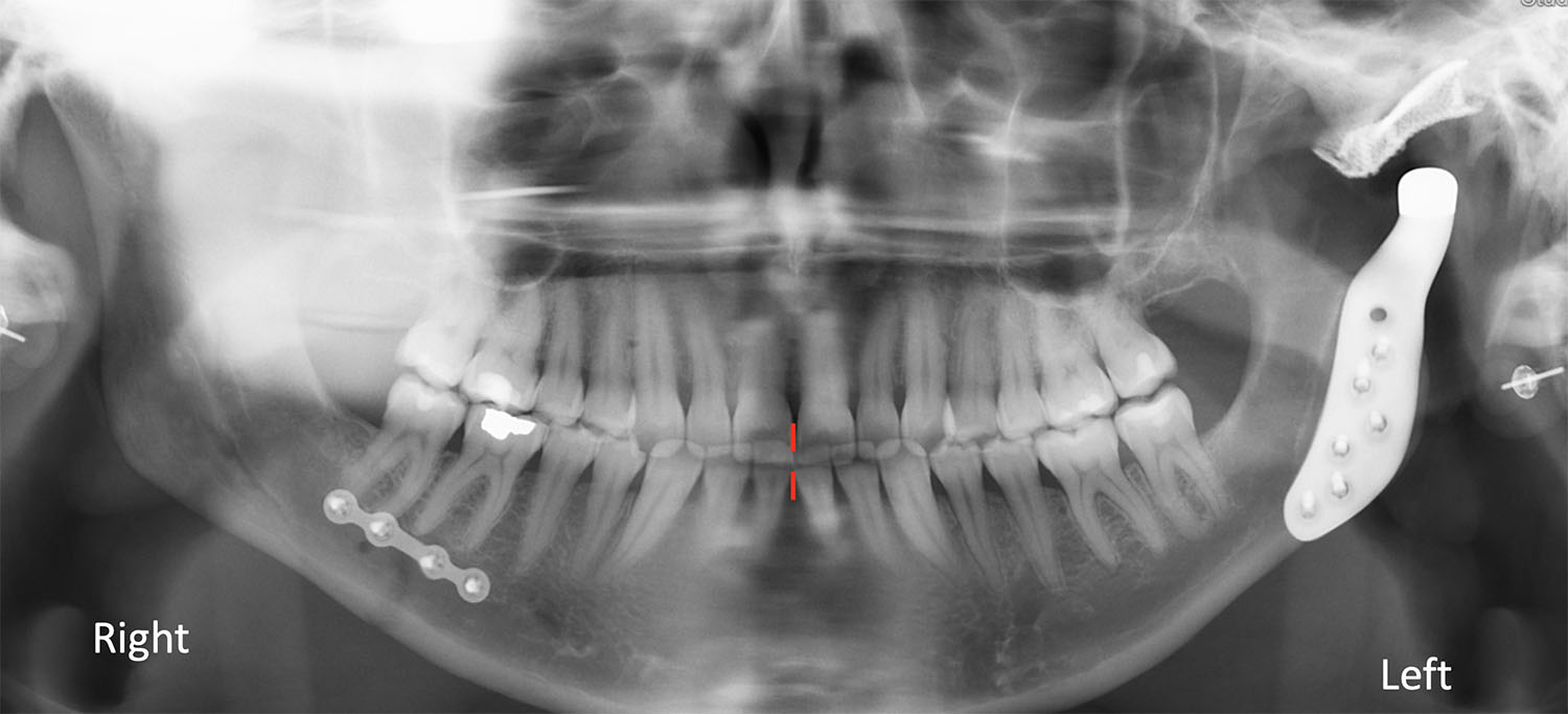 Our Expertise - Jaw Surgeries - TMJ Specialist | Oral Surgeon Arlington ...
